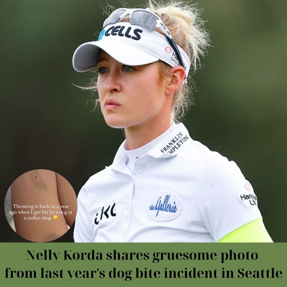 Nelly Korda shares gruesome photo from last year's dog bite incident in Seattle - News